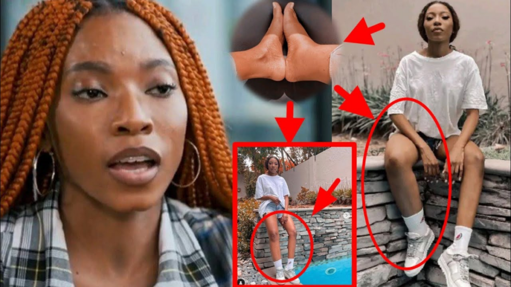 Embracing Self-Acceptance: Bahumi Madisakwane’s Journey with ...