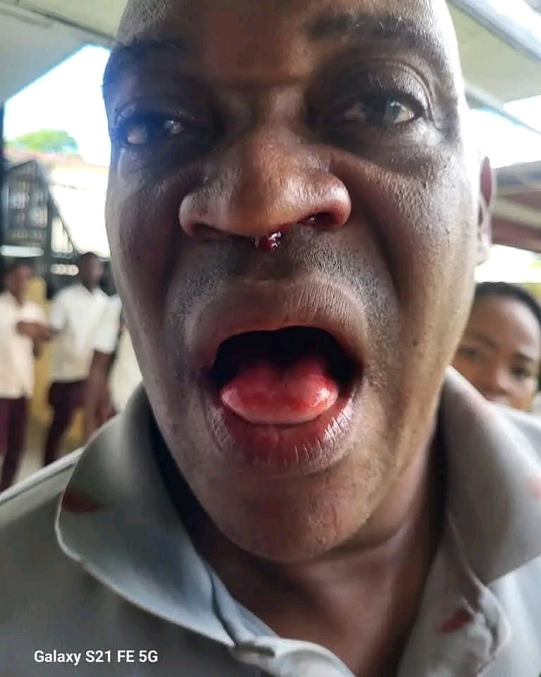 Teacher Badly Injured in Moruga Secondary School Fight with Student ...